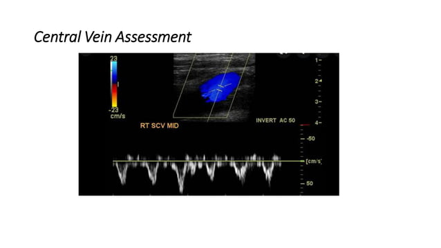 Ultrasound vascular mapping. | PDF