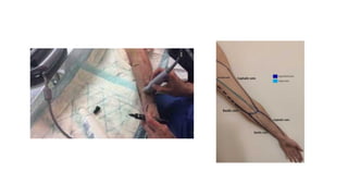 Ultrasound vascular mapping. | PDF