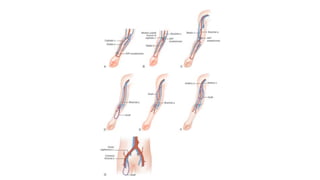 Ultrasound vascular mapping. | PDF