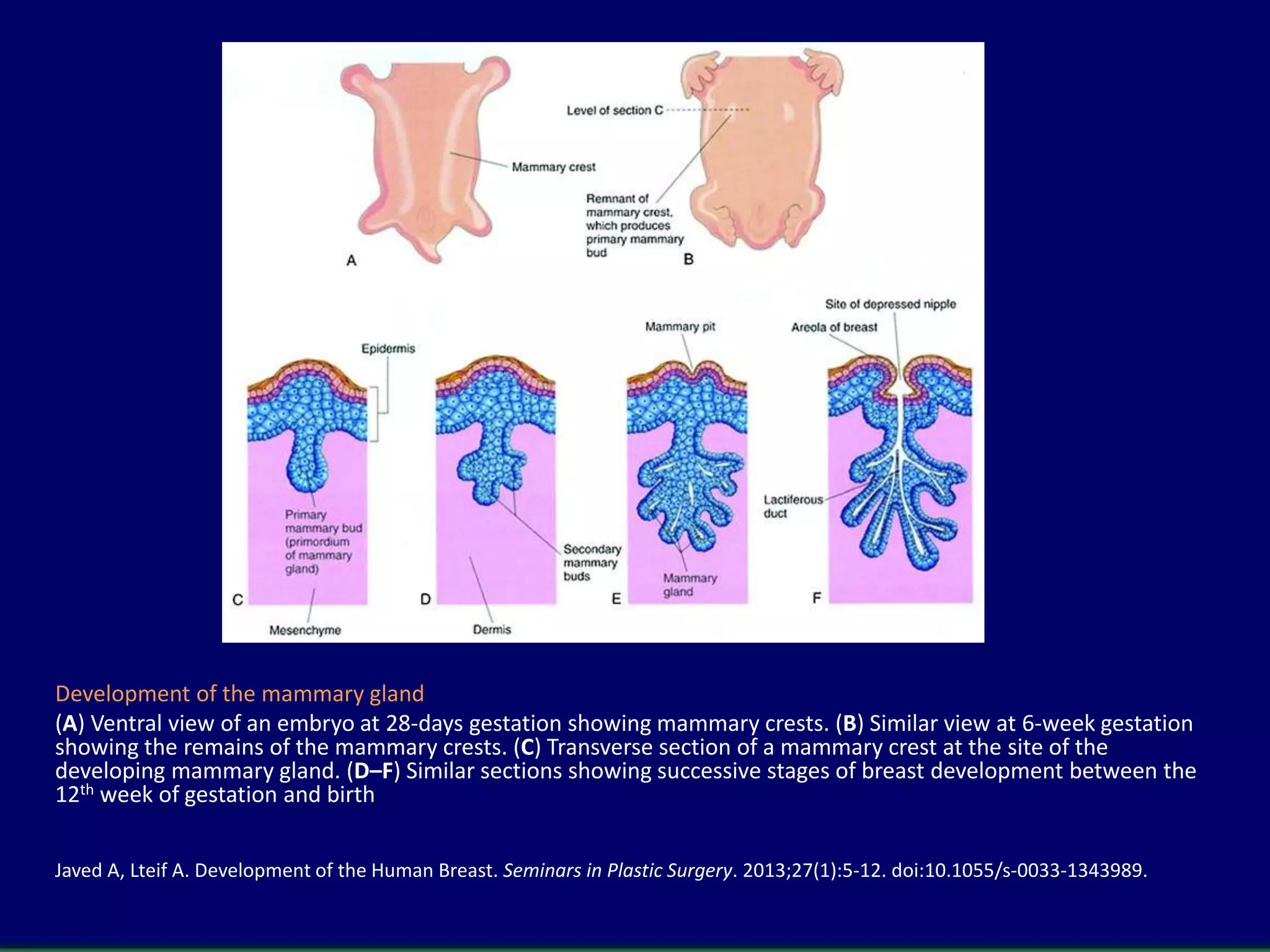 Ultrasound of pediatric and adolescent breast | PPTX