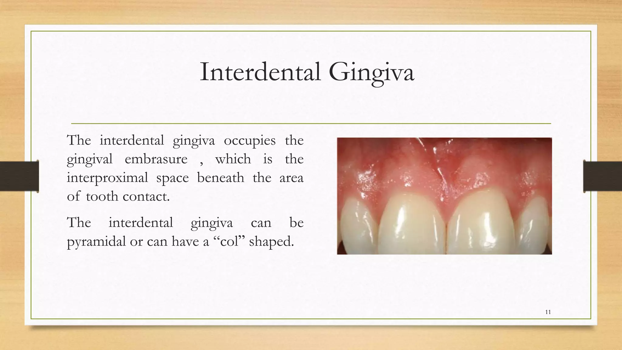 Ultrastructure of gingival epithelium in health and disease | PPTX