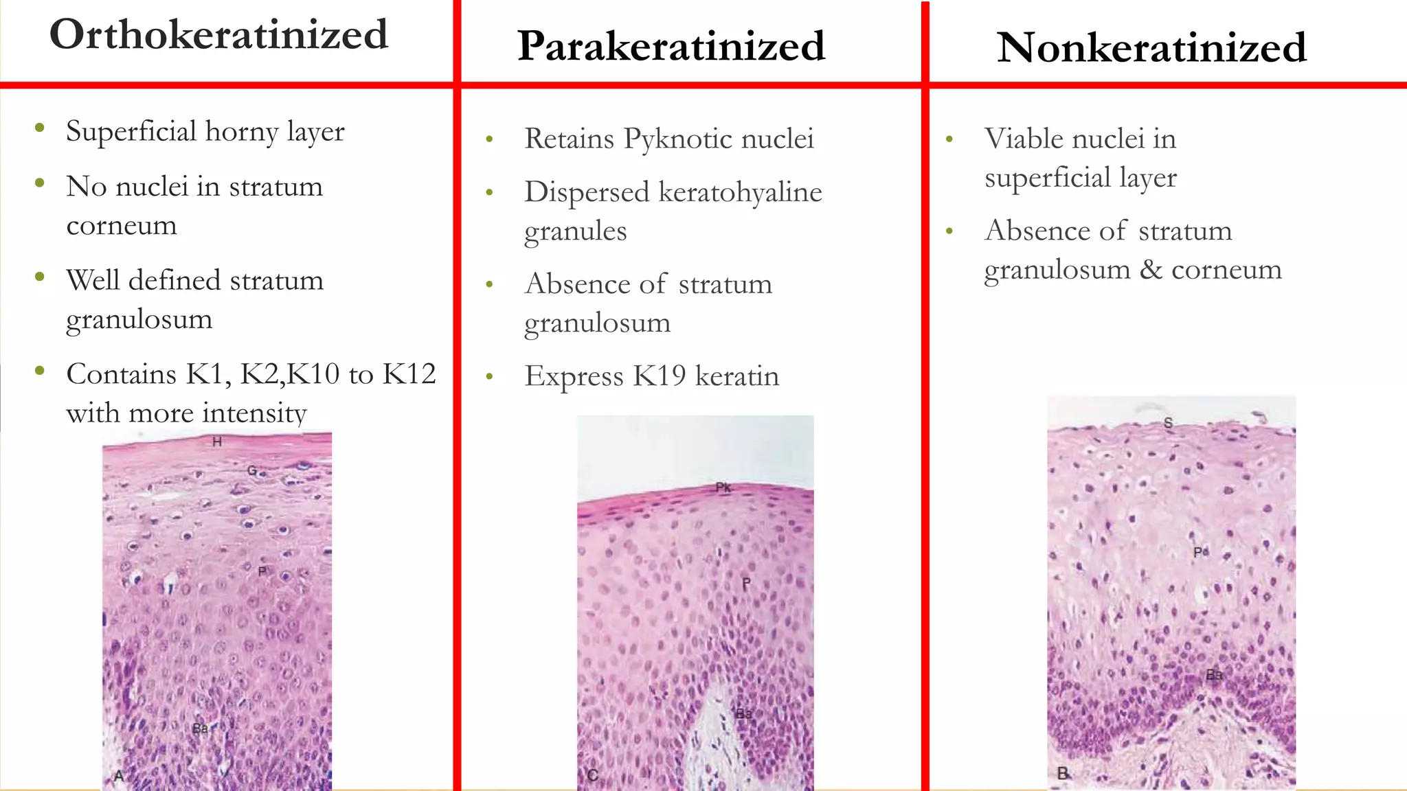 Ultrastructure of gingival epithelium in health and disease | PPTX