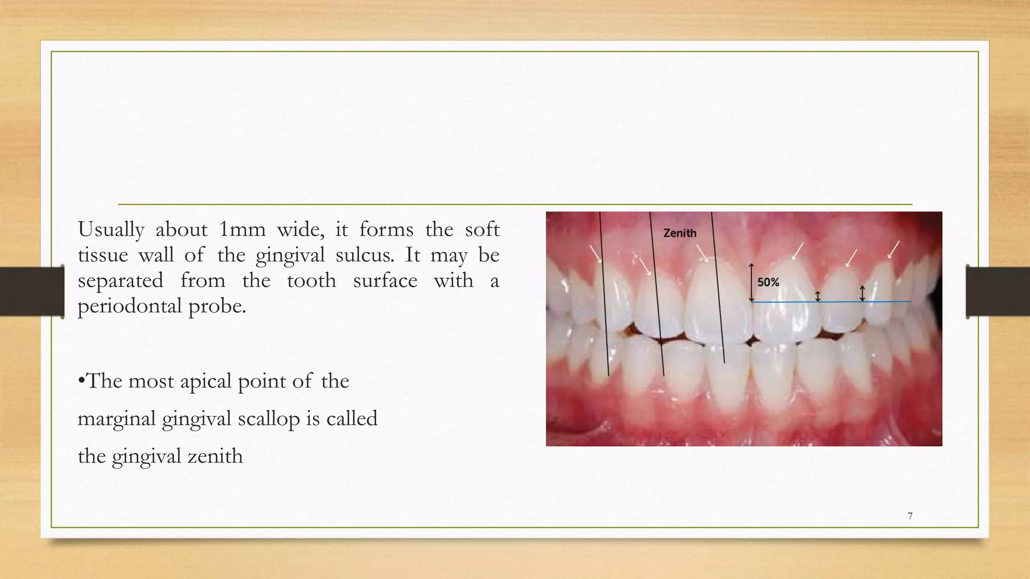 Ultrastructure of gingival epithelium in health and disease | PPTX