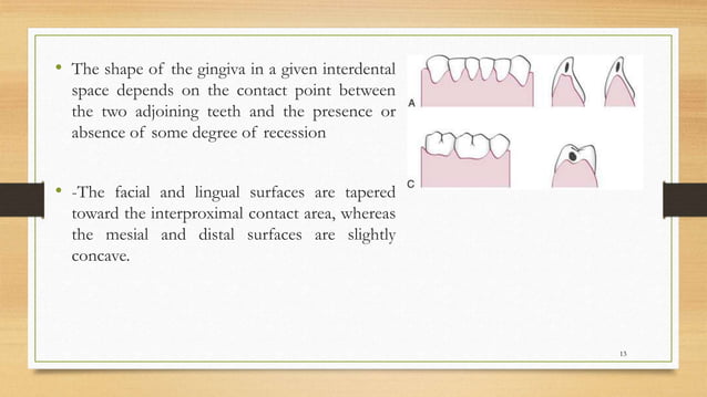 Ultrastructure of gingival epithelium in health and disease | PPTX ...
