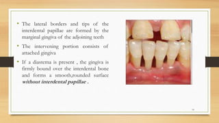 Ultrastructure of gingival epithelium in health and disease | PPTX