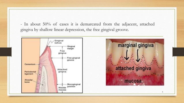 Ultrastructure of gingival epithelium in health and disease | PPTX ...