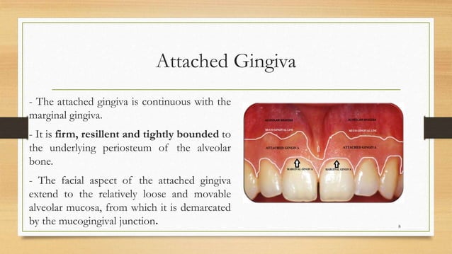 Ultrastructure of gingival epithelium in health and disease | PPTX ...