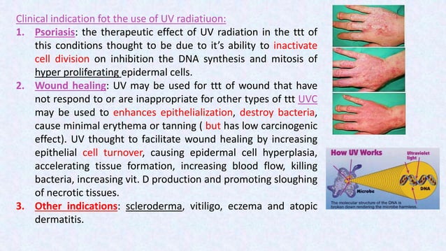 Ultraviolet principals and applications | PPTX | Skin and Dermatology ...