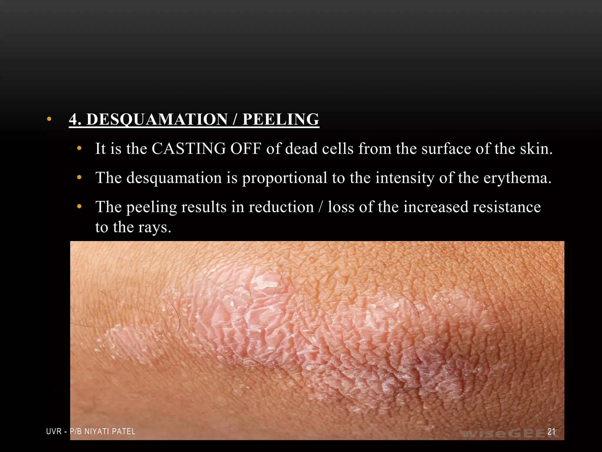 Ultra violet radiation physiotherapy | PDF