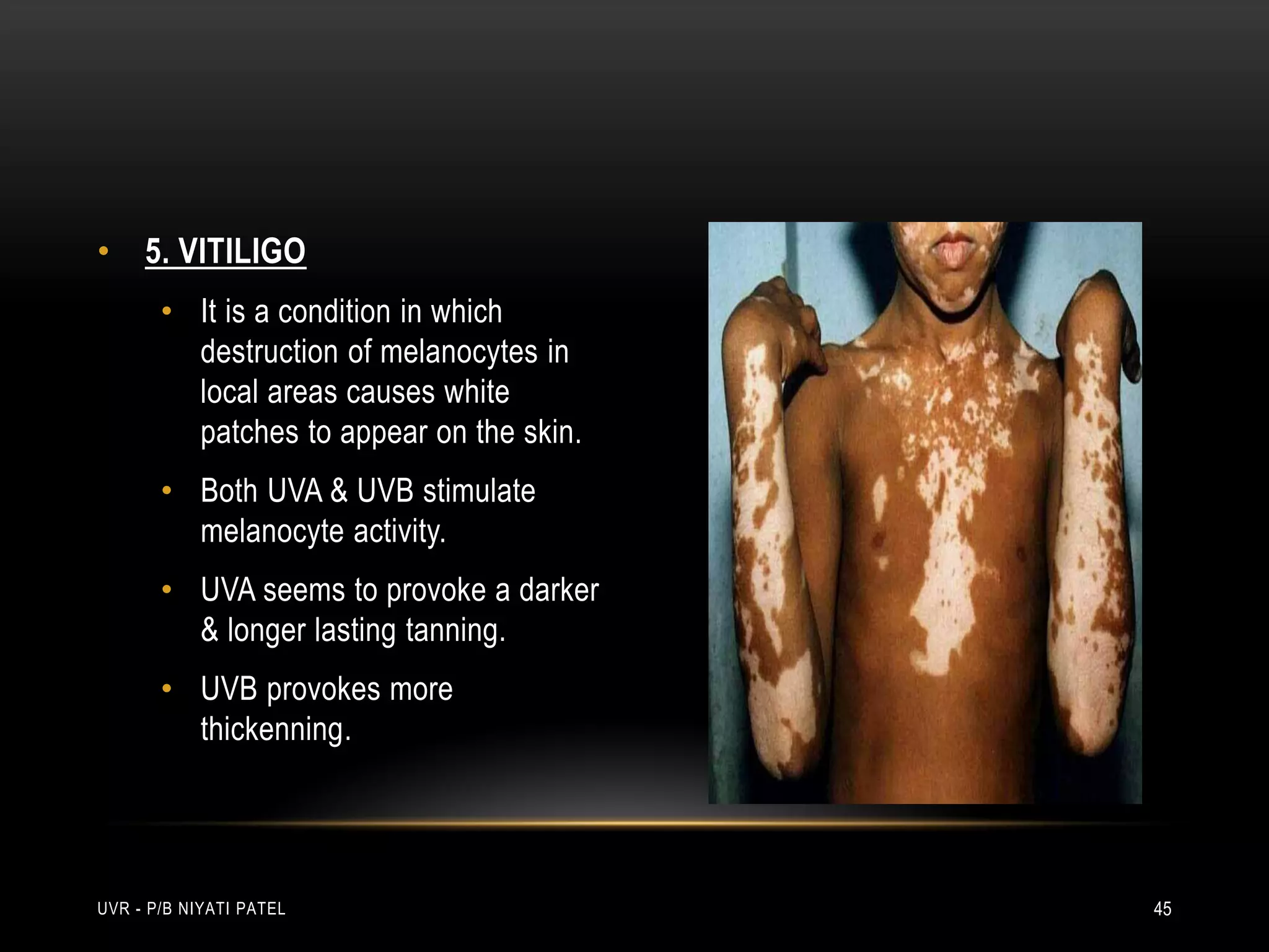 Ultra violet radiation physiotherapy | PDF