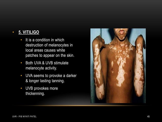 Ultra violet radiation physiotherapy | PDF