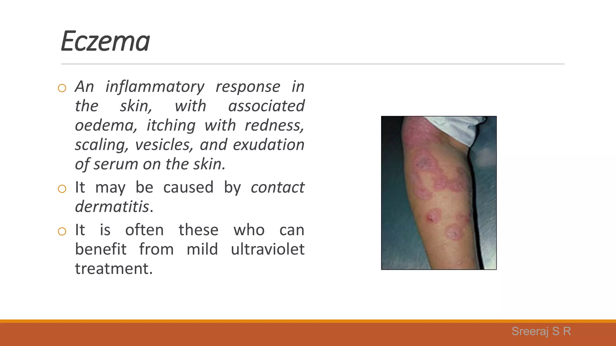 Ultraviolet radiation in Physiotherapy | PPT