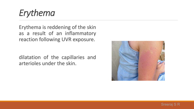 Ultraviolet radiation in Physiotherapy | PPT | Skin and Dermatology ...