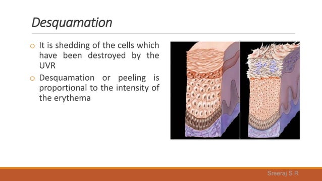Ultraviolet radiation in Physiotherapy | PPT | Skin and Dermatology ...