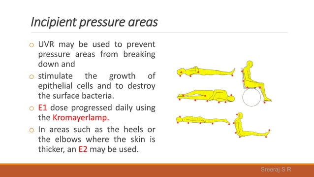 Ultraviolet radiation in Physiotherapy | PPT | Skin and Dermatology ...