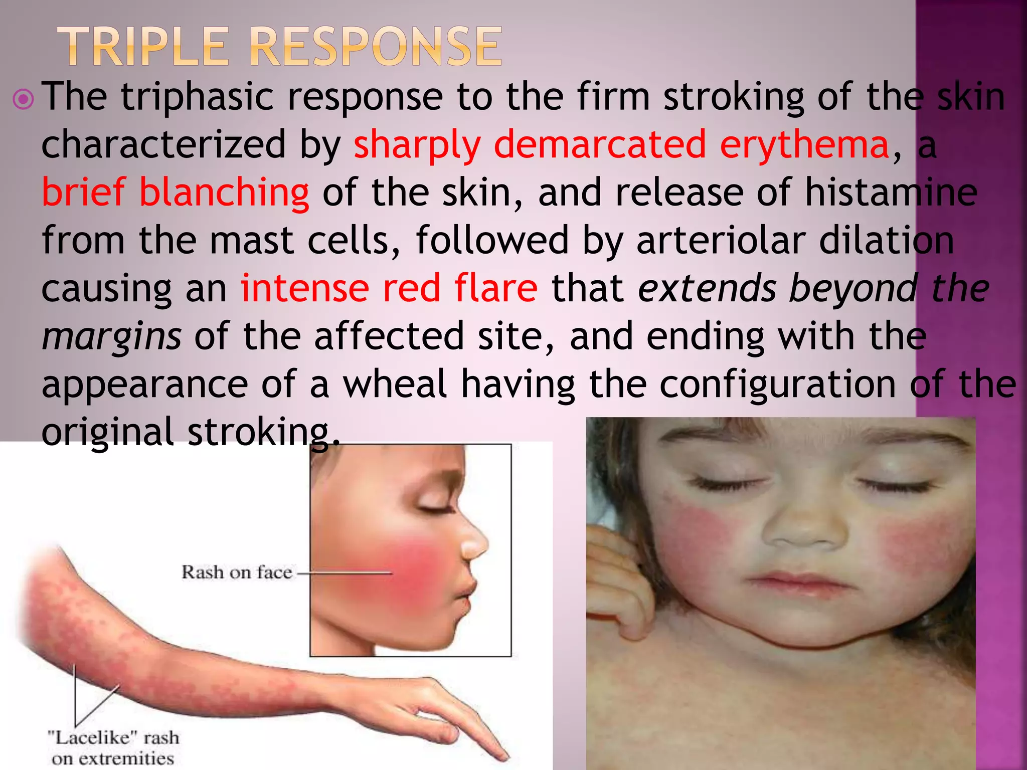 Ultraviolet Radiation (UVR) | PPTX