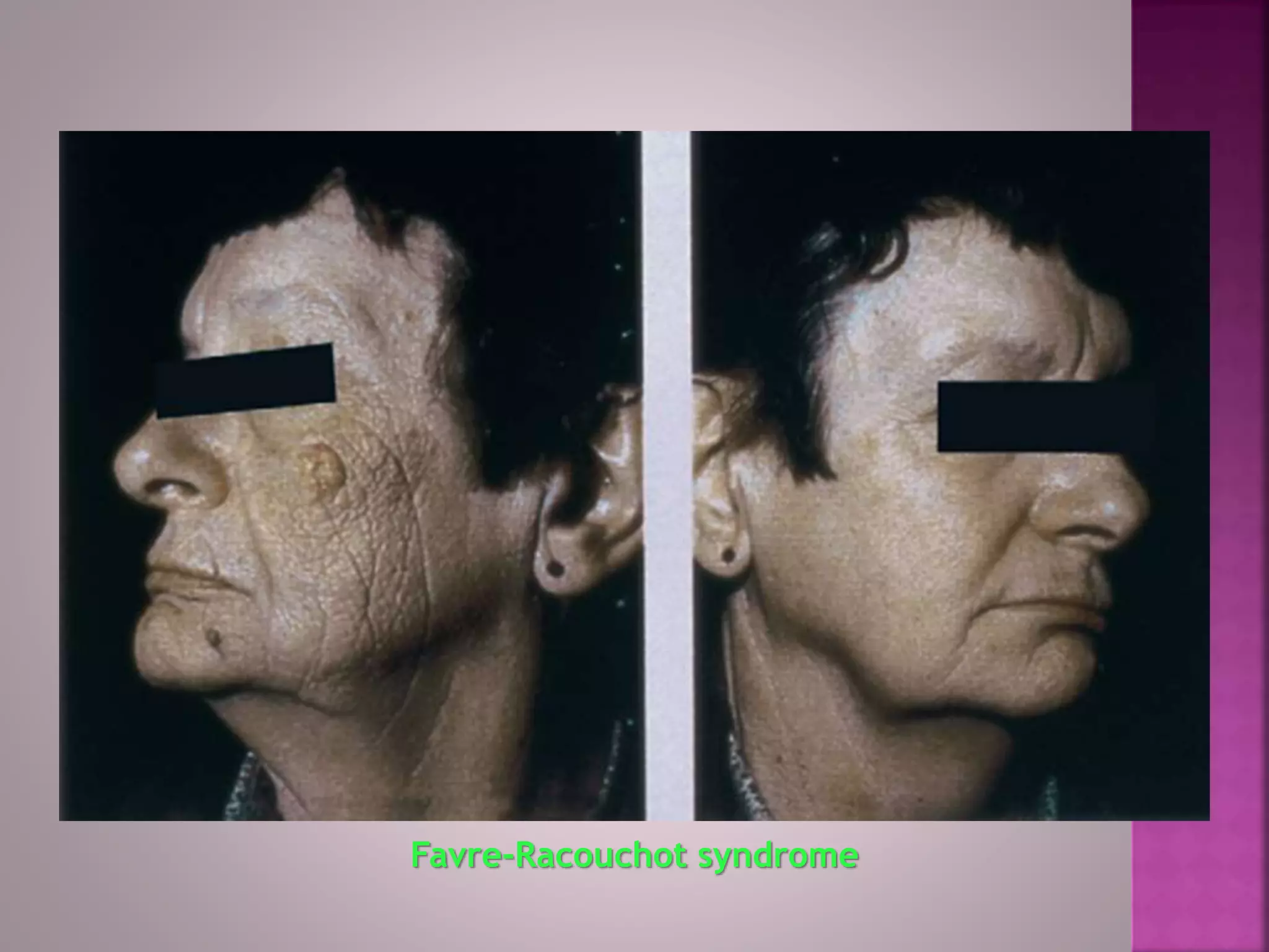 Ultraviolet Radiation (UVR) | PPTX