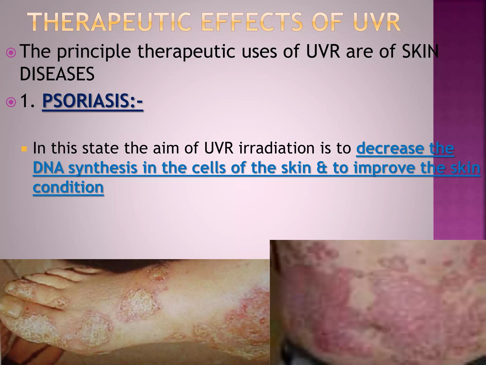 Ultraviolet Radiation (UVR) | PPTX