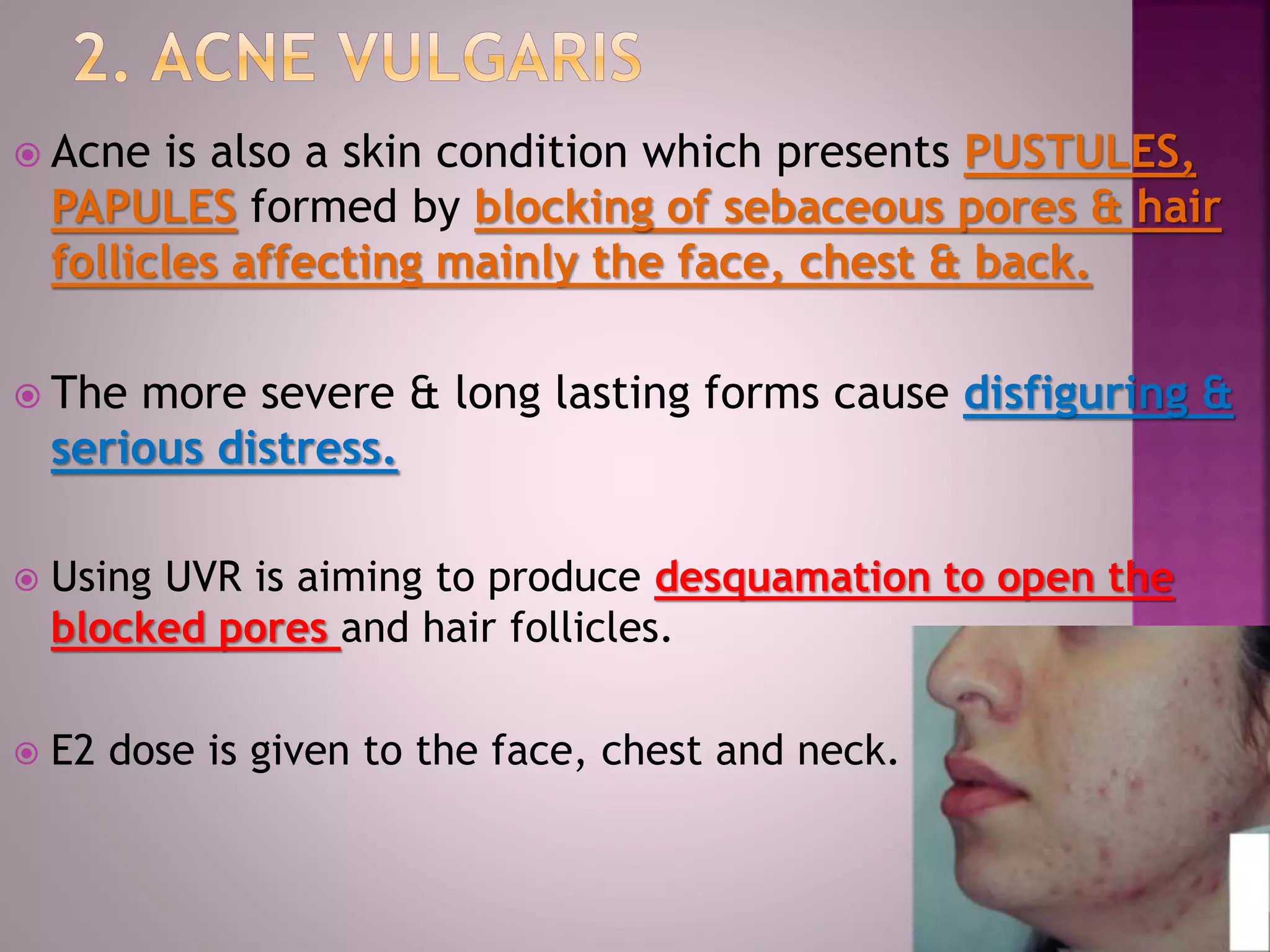 Ultraviolet Radiation (UVR) | PPTX