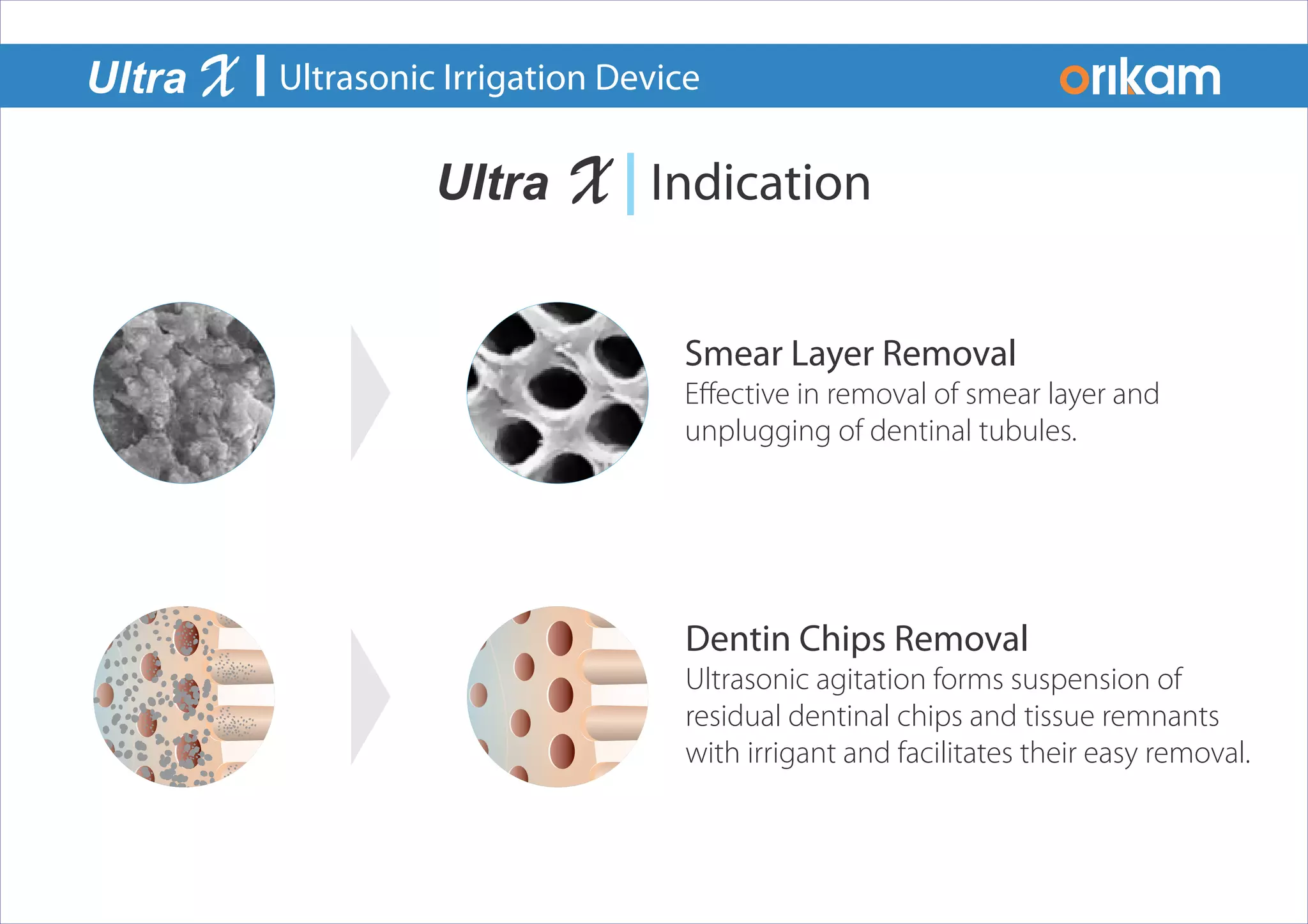 Ultra X Ultrasonic Device | PDF