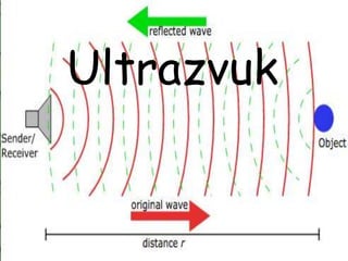 Ultrazvuk | PPTX
