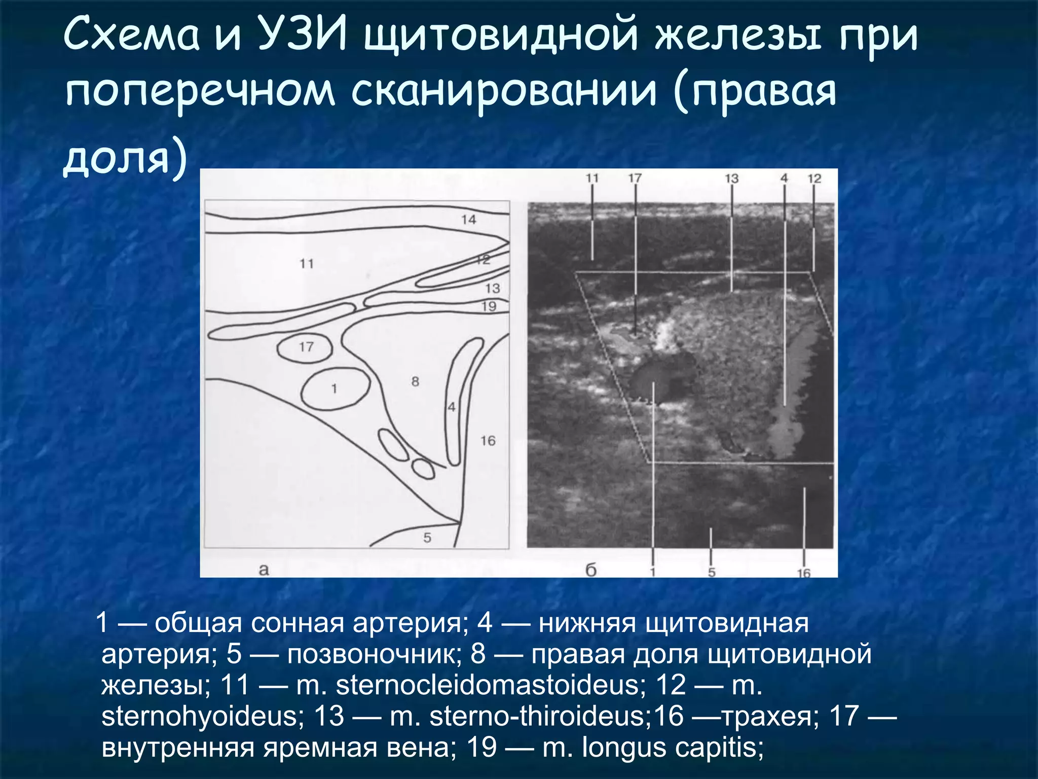 ultrazvukovaya-diagnostika-zabolevaniy-organov-shei-i-shchitovidnoy-zhelezy.pptx