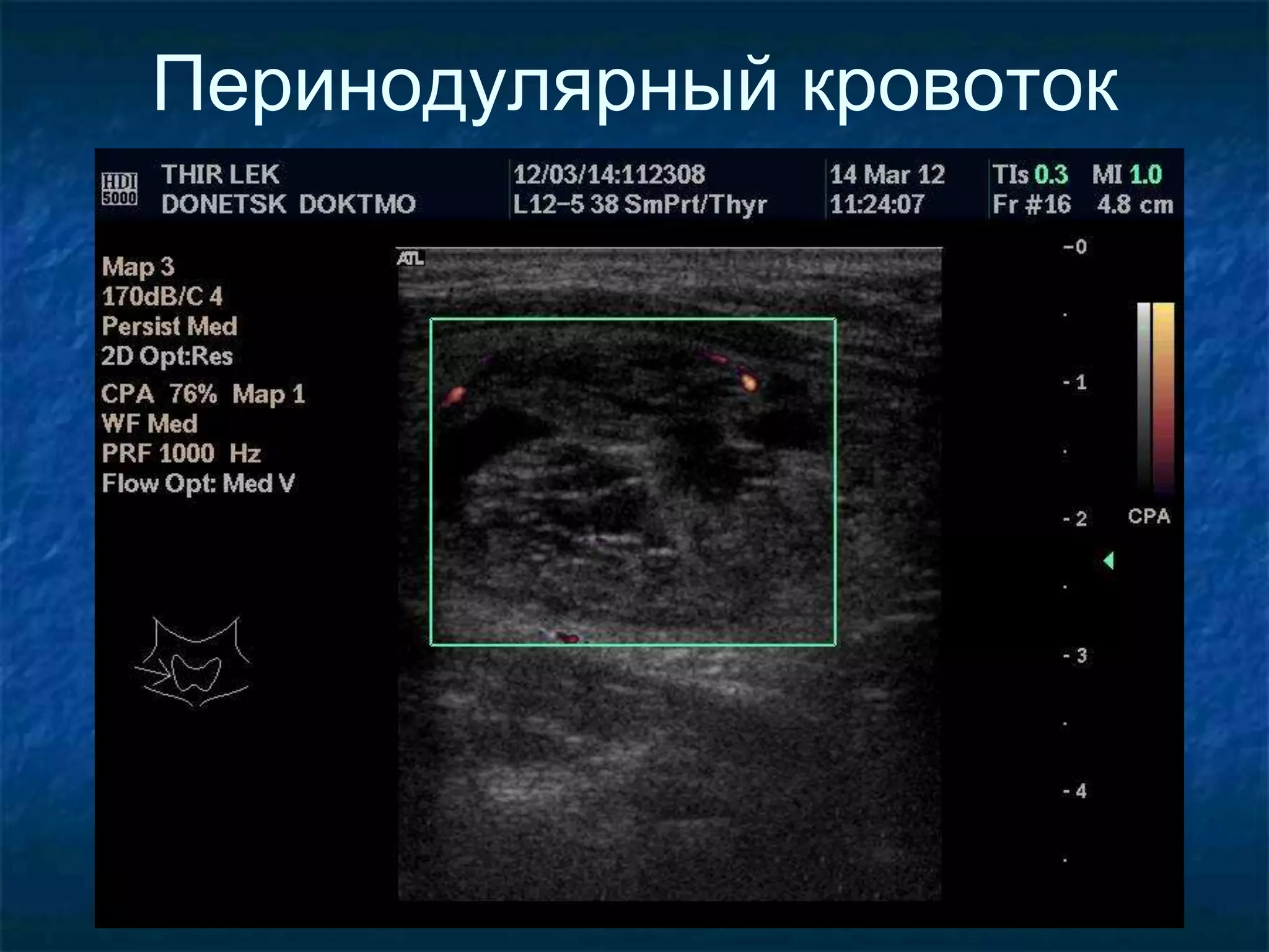 ultrazvukovaya-diagnostika-zabolevaniy-organov-shei-i-shchitovidnoy-zhelezy.pptx