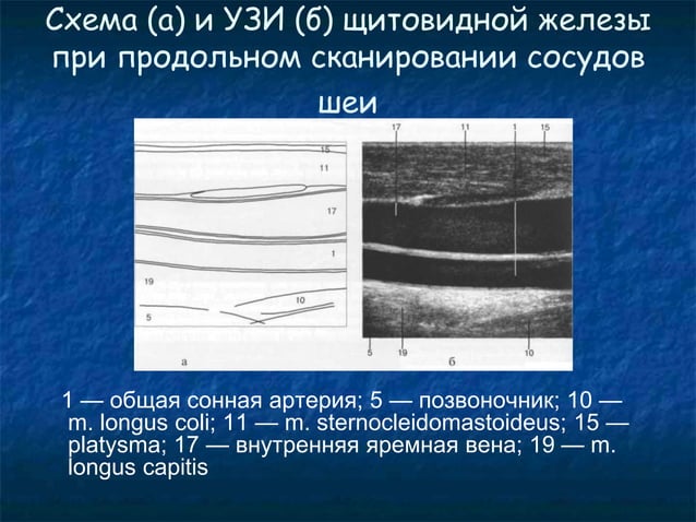 ultrazvukovaya-diagnostika-zabolevaniy-organov-shei-i-shchitovidnoy-zhelezy.pptx