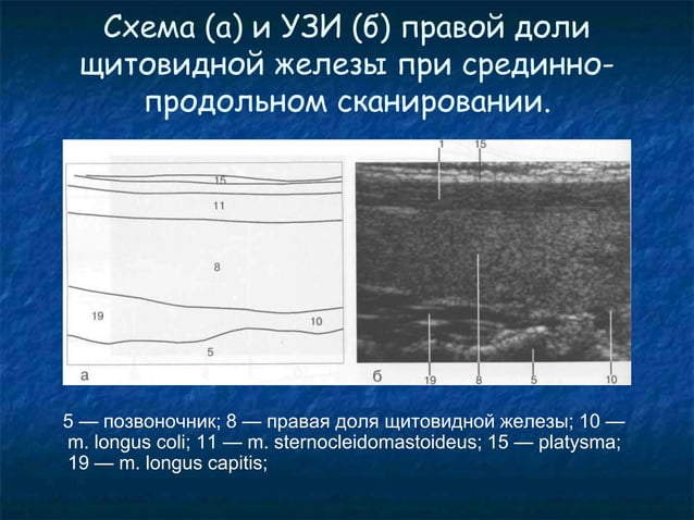 ultrazvukovaya-diagnostika-zabolevaniy-organov-shei-i-shchitovidnoy-zhelezy.pptx