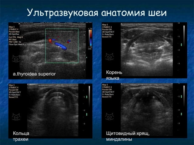 ultrazvukovaya-diagnostika-zabolevaniy-organov-shei-i-shchitovidnoy-zhelezy.pptx