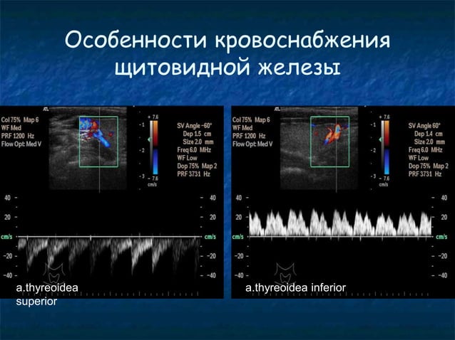 ultrazvukovaya-diagnostika-zabolevaniy-organov-shei-i-shchitovidnoy-zhelezy.pptx