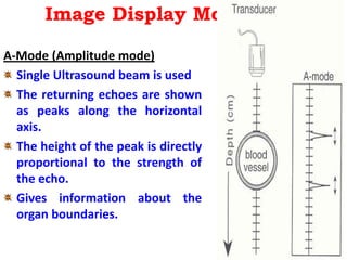 Ultrsonography Principle and application | PPTX
