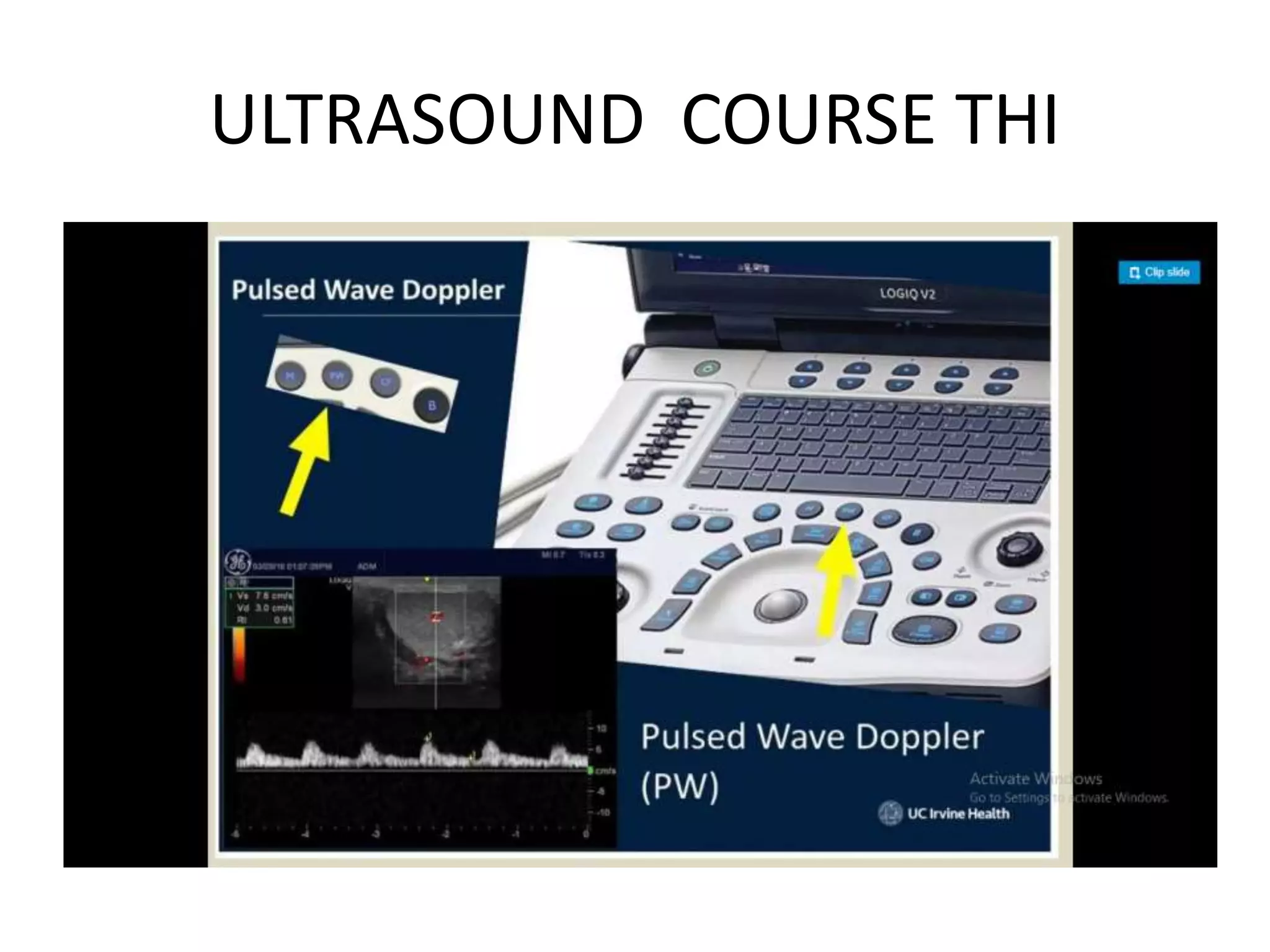 Ultrasound basics | PPTX