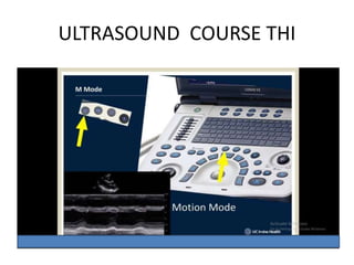 Ultrasound basics | PPT
