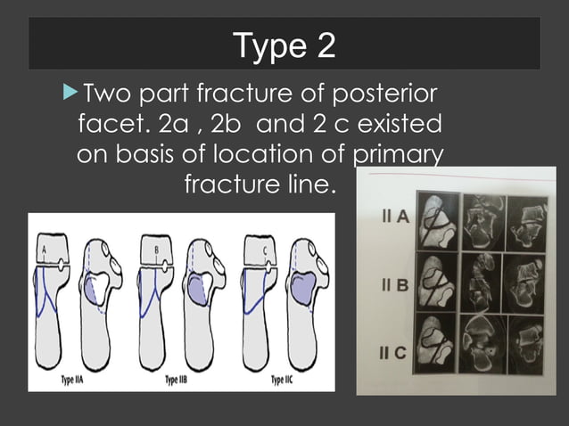 Umar Sultan hshahahhwuiiwbbbhhaiujah.pptx
