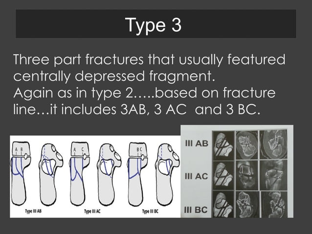 Umar Sultan hshahahhwuiiwbbbhhaiujah.pptx