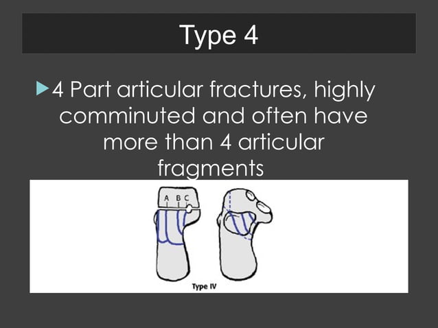 Umar Sultan hshahahhwuiiwbbbhhaiujah.pptx