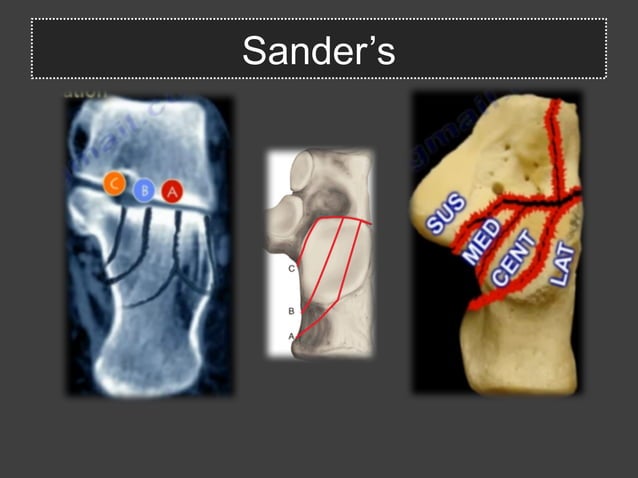 Umar Sultan hshahahhwuiiwbbbhhaiujah.pptx