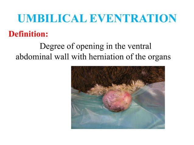 Umbilical disease | PPTX