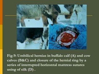 Umbilical affections | PPT