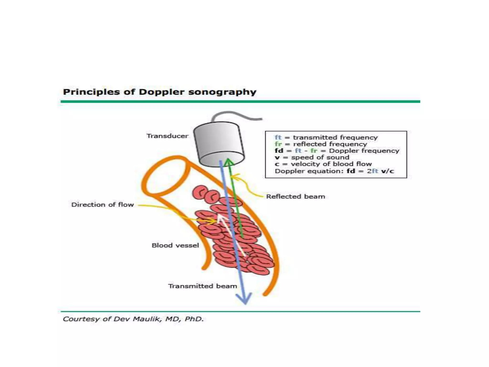 Umbilical artery doppler [1] | PPTX