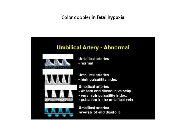 Umbilical artery doppler [1] | PPTX | Pregnancy | Reproductive Health