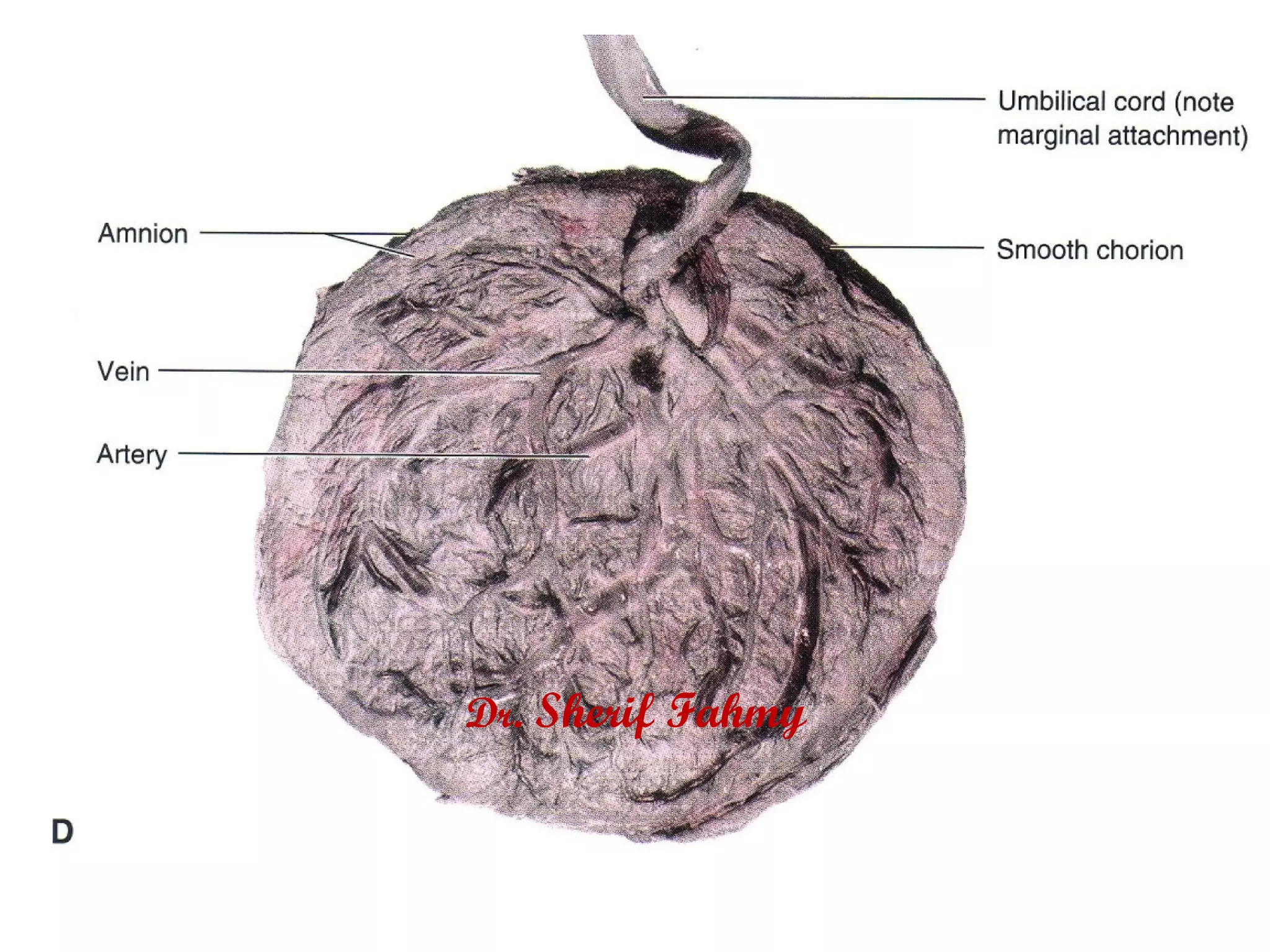 Umbilical Cord (General Embryology) | PPS