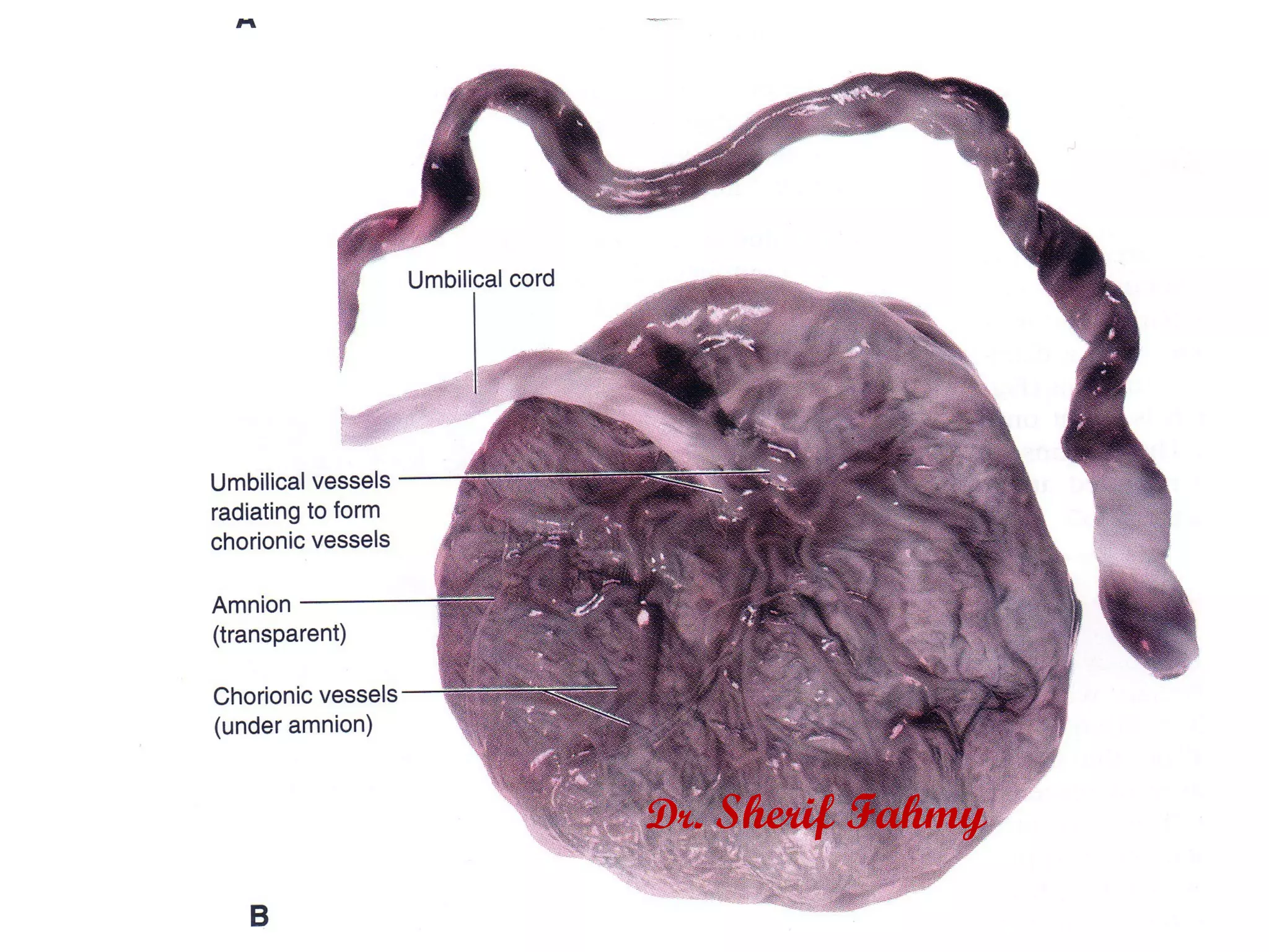 Umbilical Cord (General Embryology) | PPS