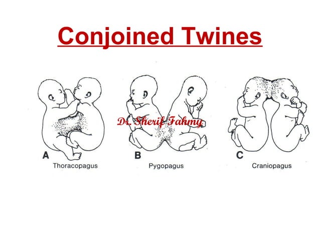 Umbilical Cord (General Embryology) | PPS | Pregnancy | Reproductive Health