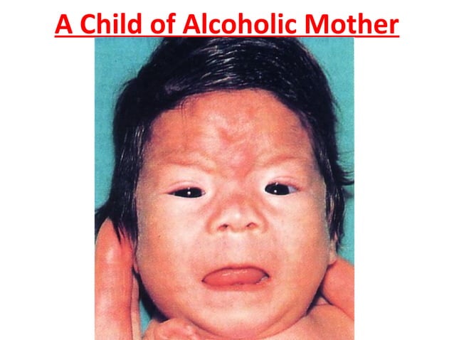 Umbilical Cord (General Embryology) | PPS | Pregnancy | Reproductive Health