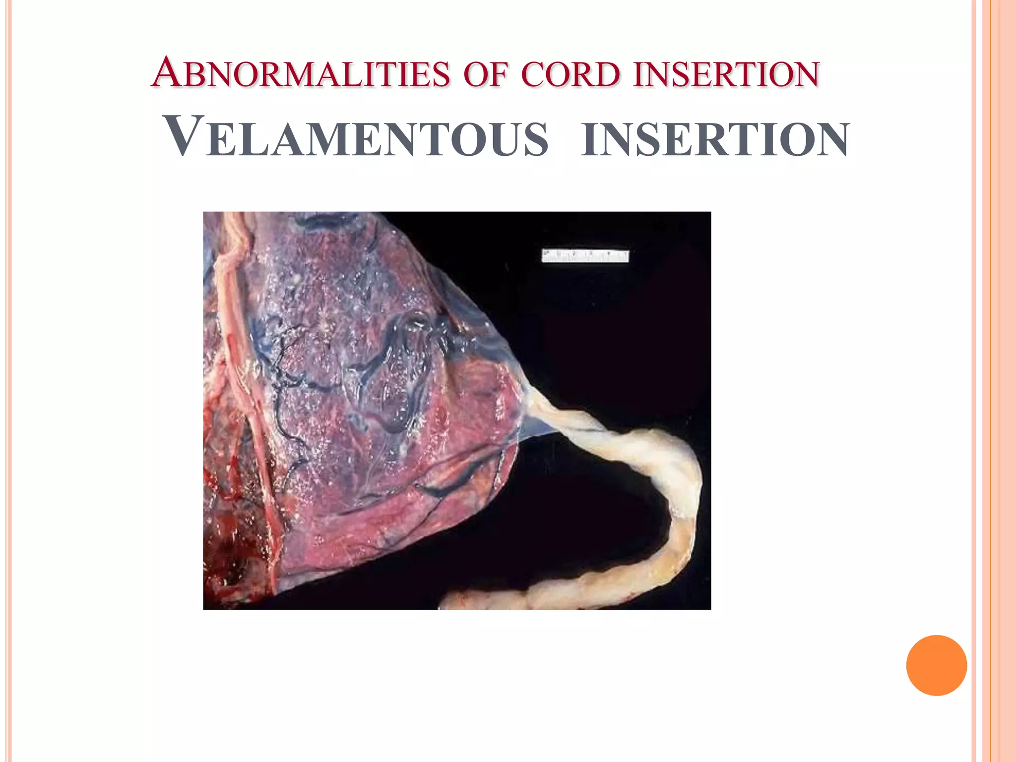 Umbilical cord | PPTX