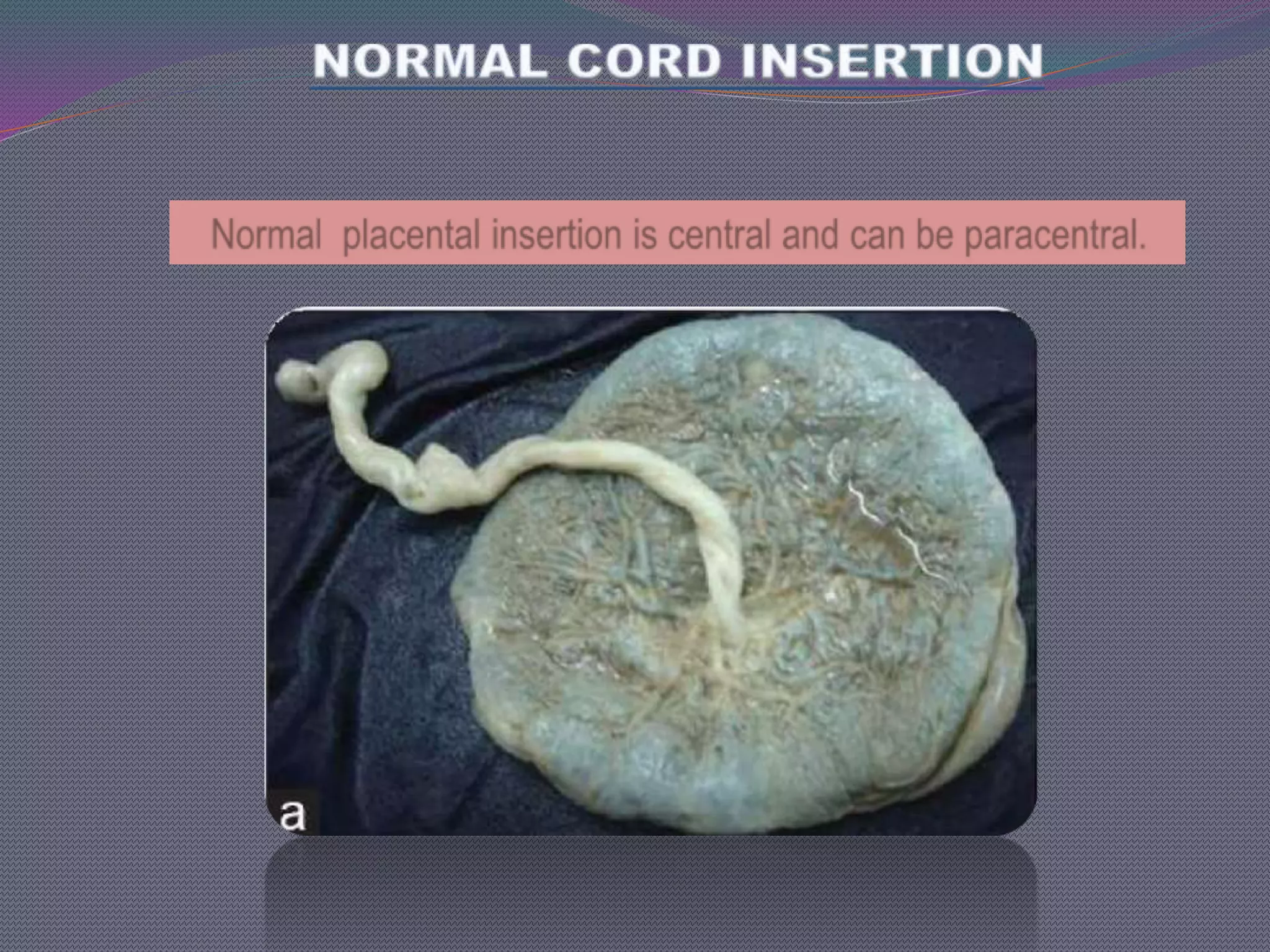 Umbilical cord.pptx