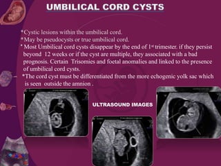 Umbilical cord.pptx