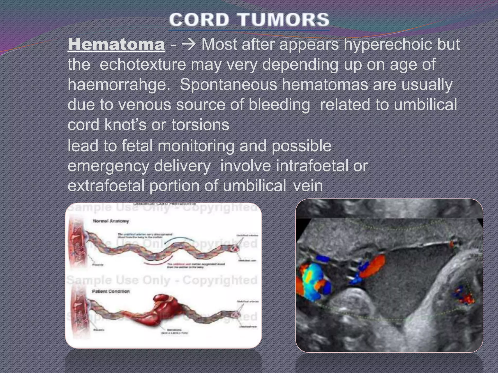 Umbilical cord.pptx